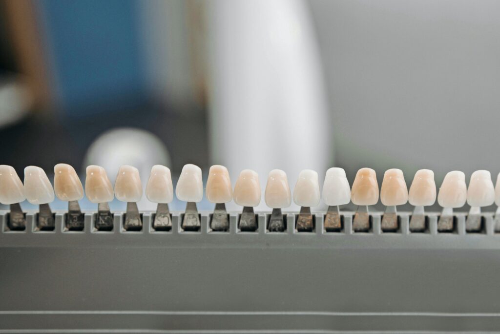 Replacing Missing Teeth in Buffalo at Smile Center